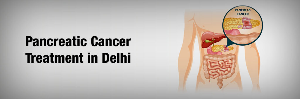 Best Pancreatic Cancer Treatment in Delhi - Dr. Asit Arora